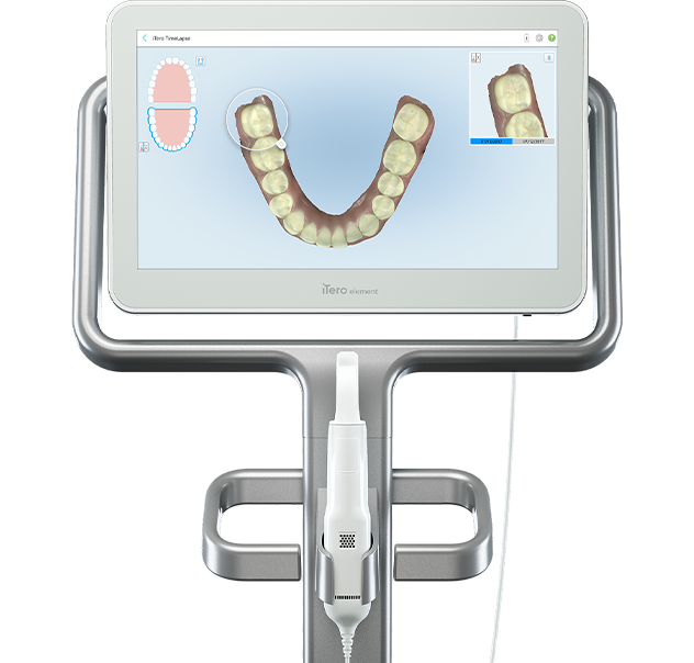 Invisalign Clear Braces in Montgomery, OH - Straight Teeth Loveland ...